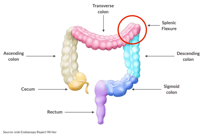 Choosing Between Modifier 53 And 52 (Gastroenterology Example ...
